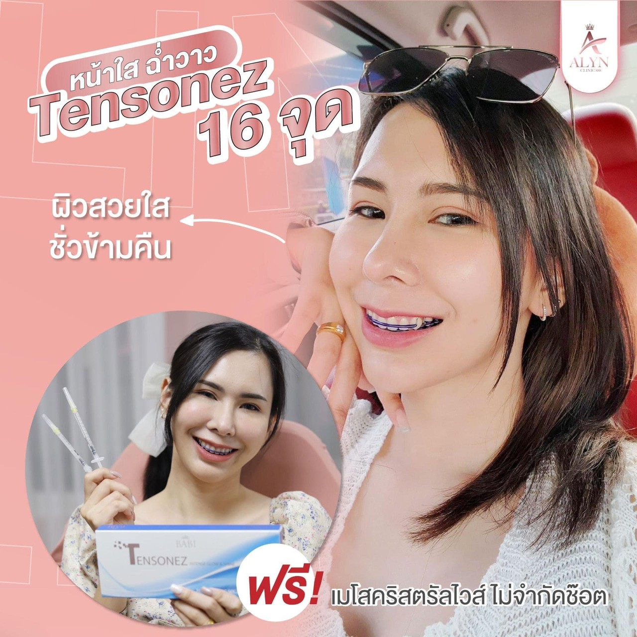 Tensonez 16 จุด หน้าใส ฉ่ำวาว - Alyn Clinic