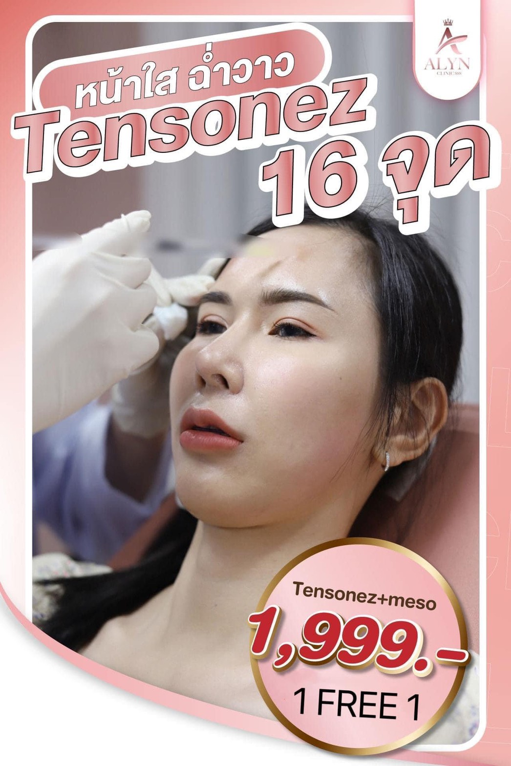 Tensonez 16 จุด หน้าใส ฉ่ำวาว - Alyn Clinic
